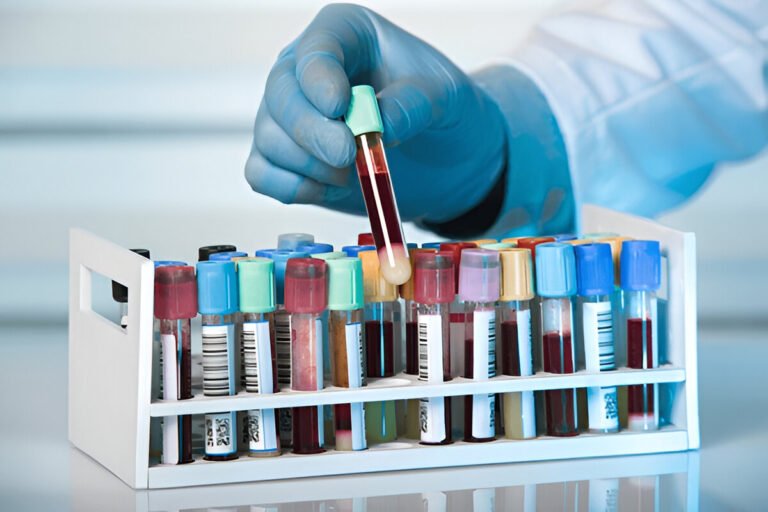 Blood Collection Tubes: Types and Their Uses - Anamol Laboratories Pvt ...